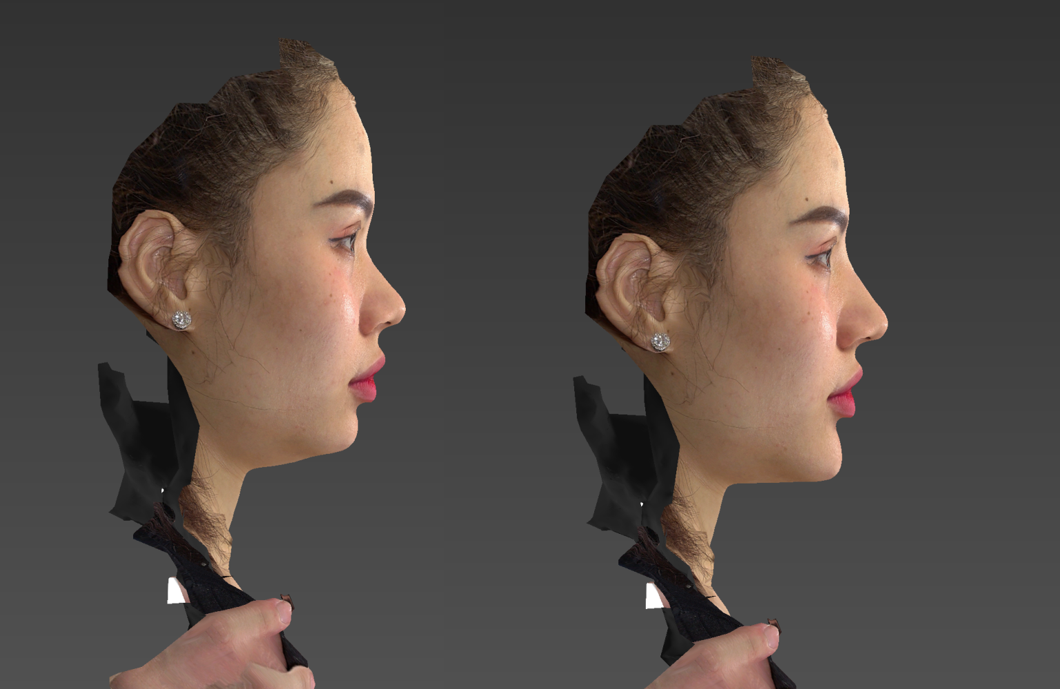 CÔNG NGHỆ MÔ PHỎNG VECTRA XT 3D XEM TRƯỚC DIỆN MẠO TƯƠNG LAI - Thẩm Mỹ ...